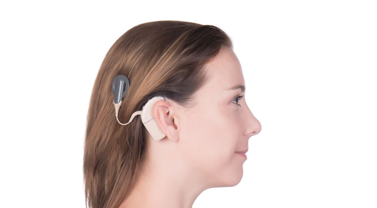 implante-coclear-madrid - Instituto ORL-IOM